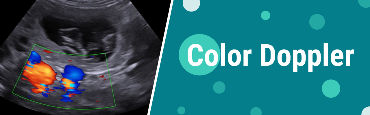 Color Doppler - Redhills Diagnostic Centre